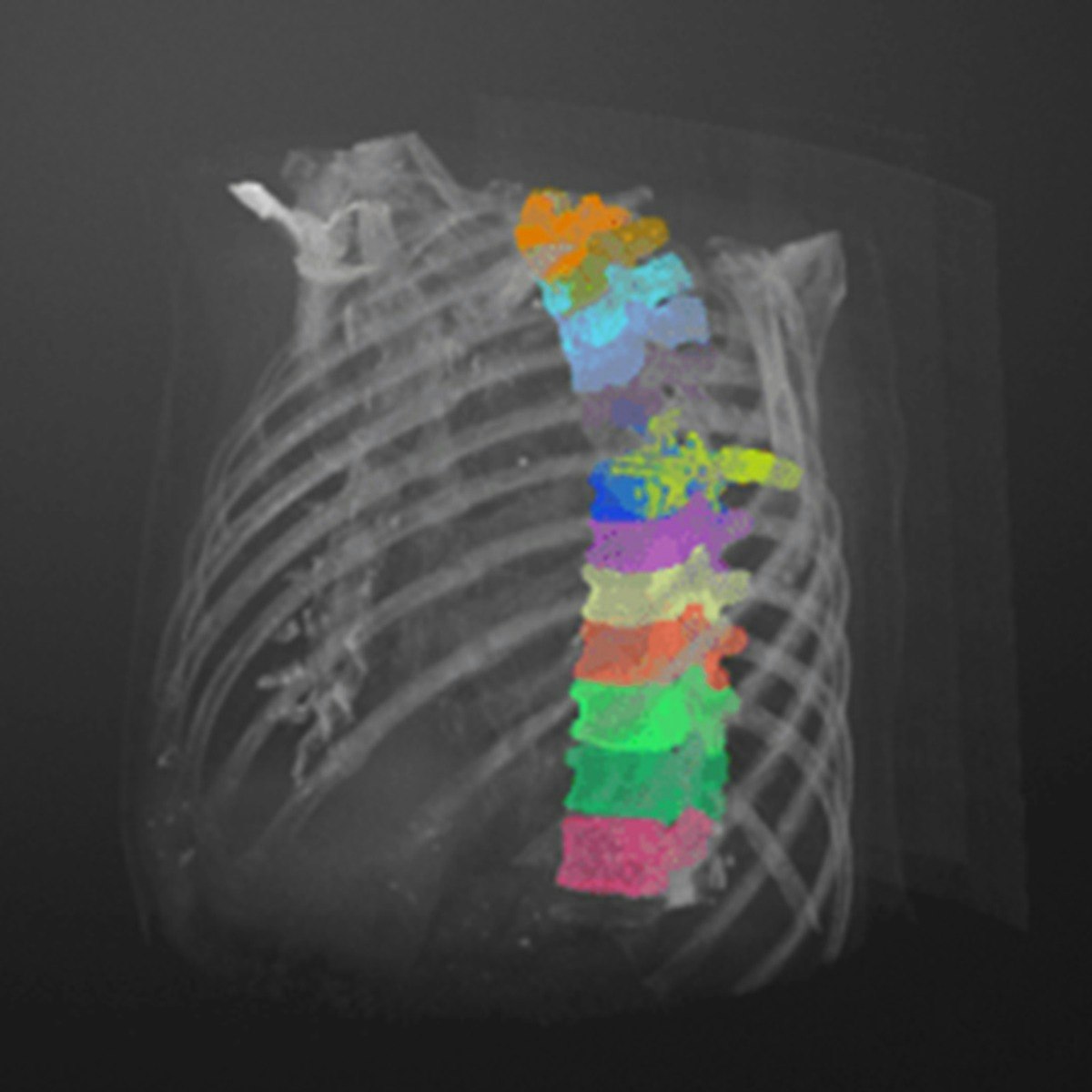 Medical Image Processing | Datafloq